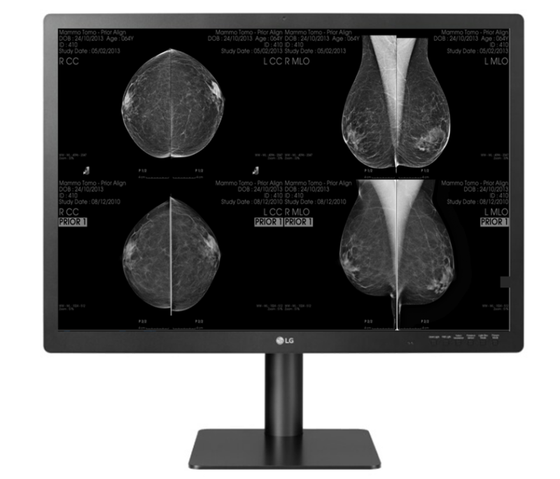 Mammography - Medecom